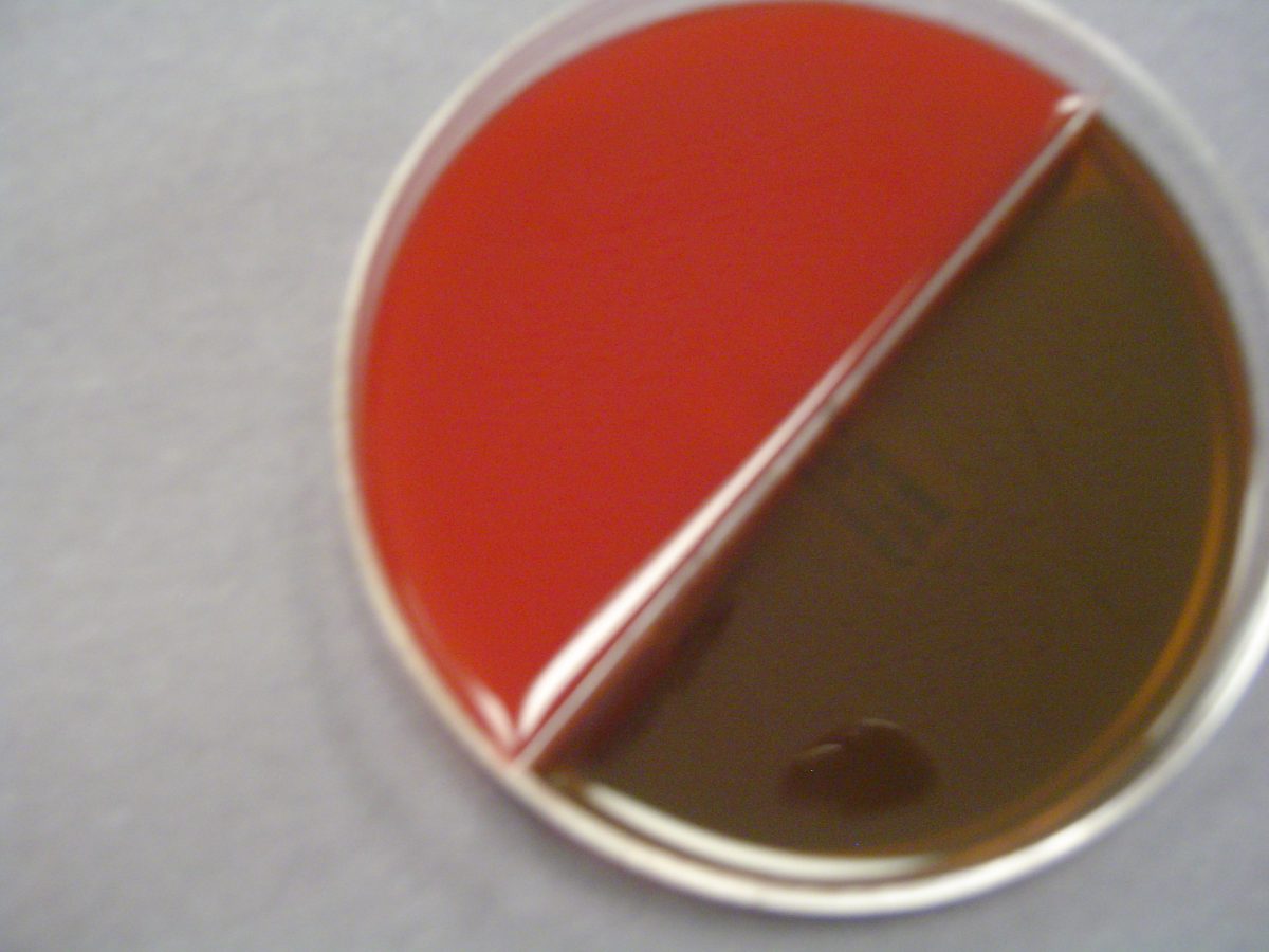 Impact Diagnostic: Culture Media Medical Supplies